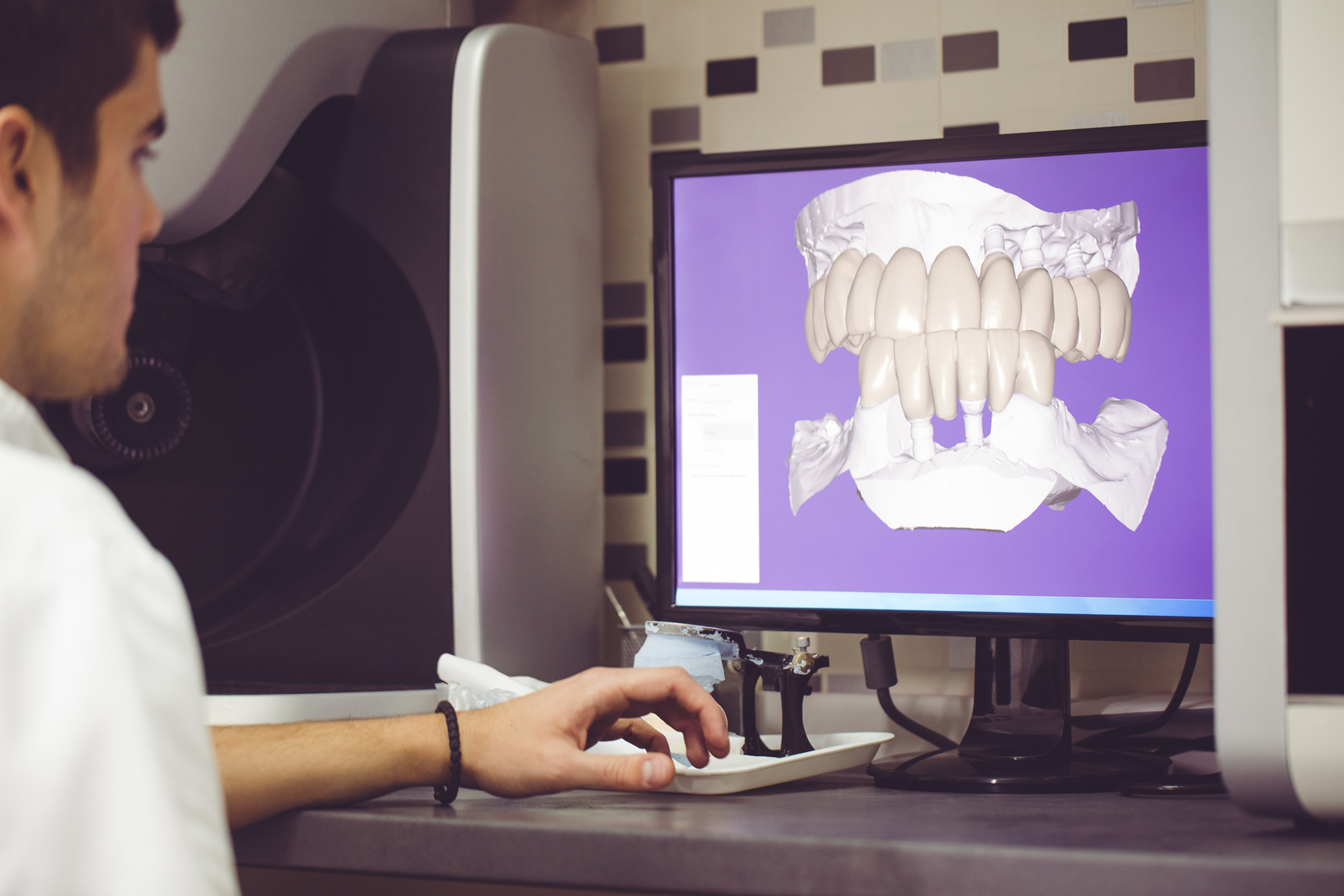 Benefits of Guided Implant Surgery | Digital Technology for Dental Implants